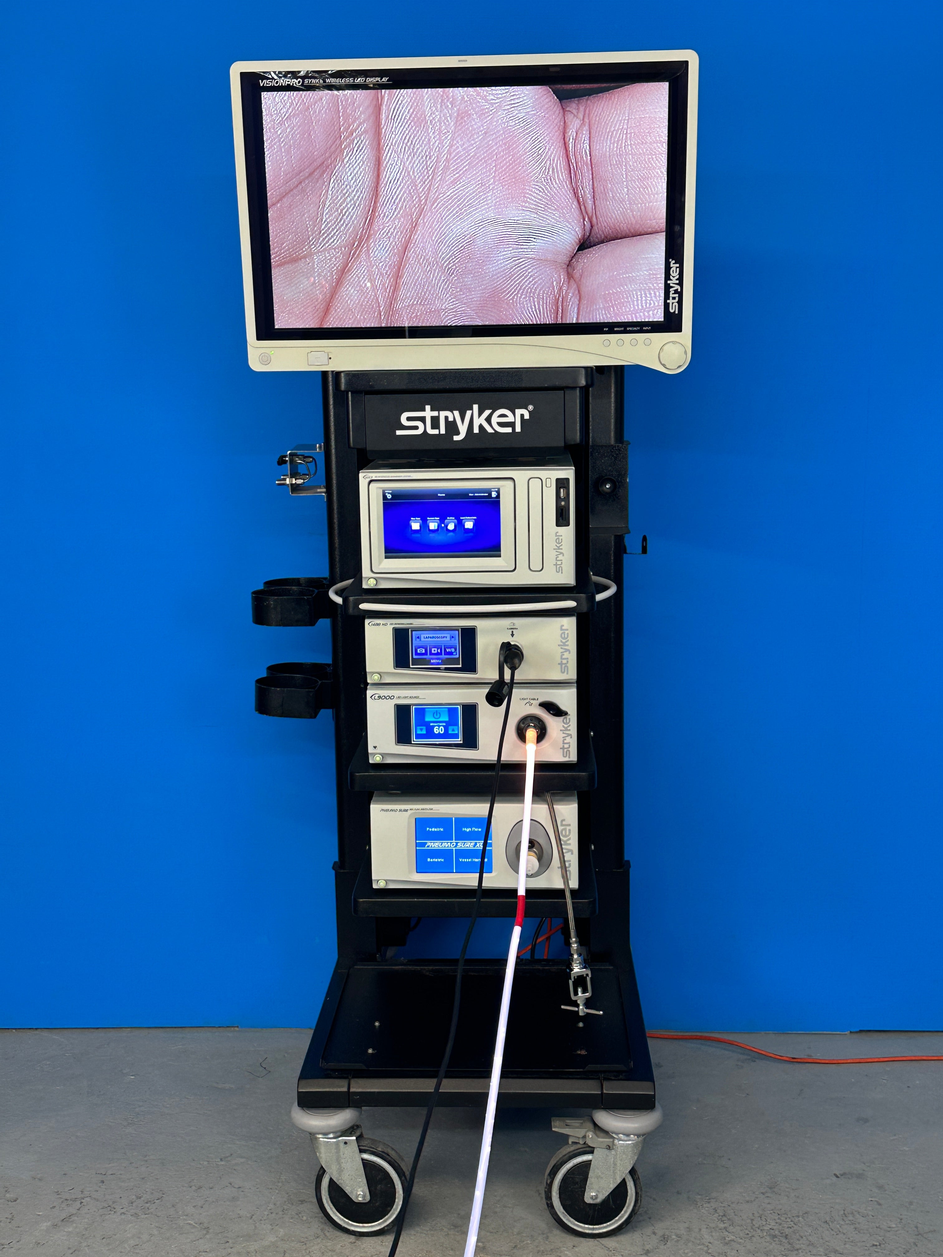 Stryker 1488 HD Laparoscopy Tower Stack System – MedGill Ltd