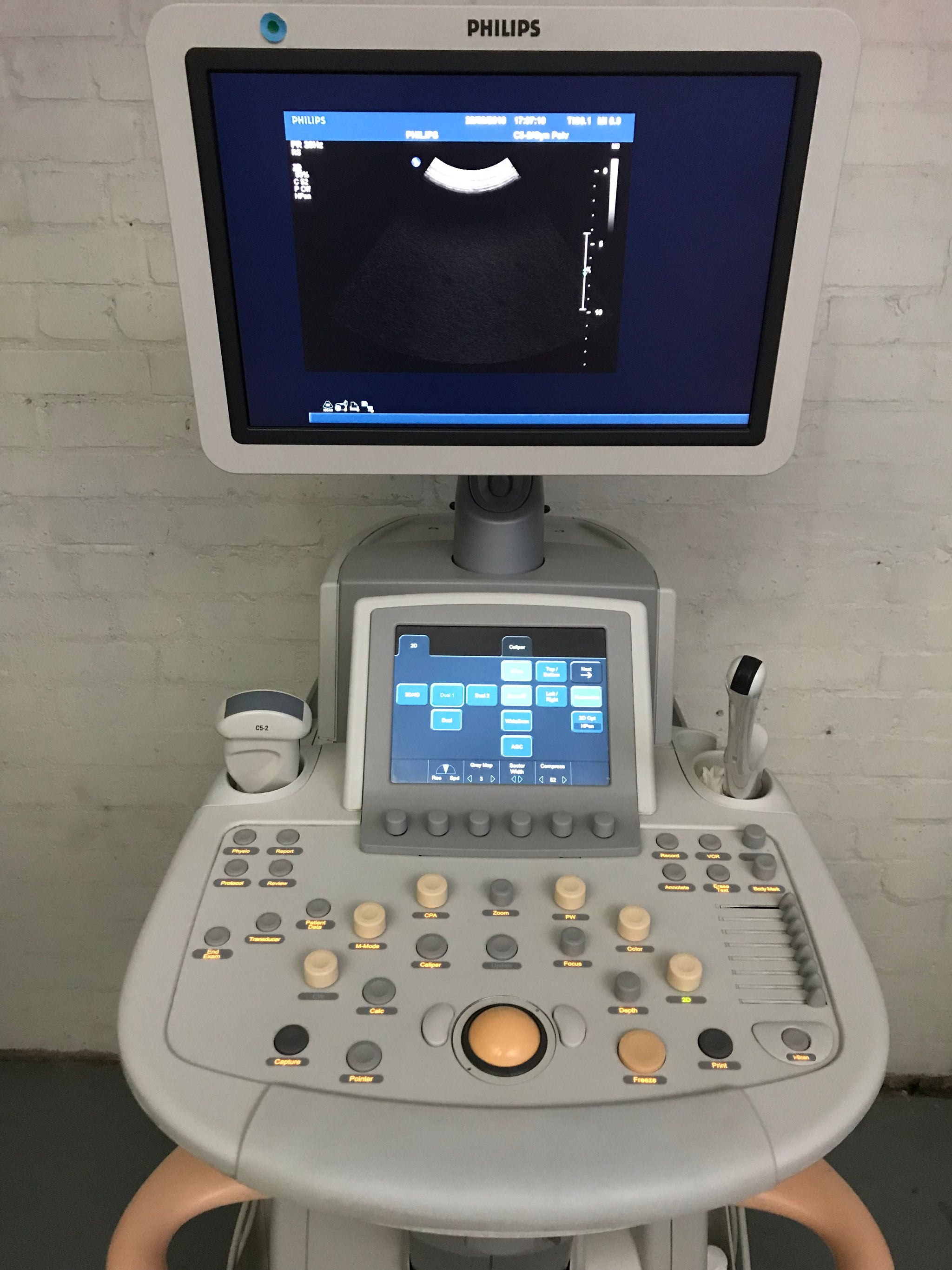 Philips IU22 Ultrasound machine – MedGill Ltd