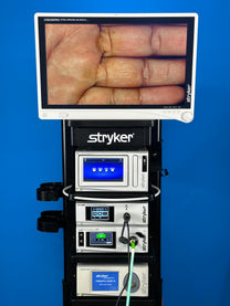 Stryker 1588 AIM Laparoscopy Tower Stack System – MedGill Ltd