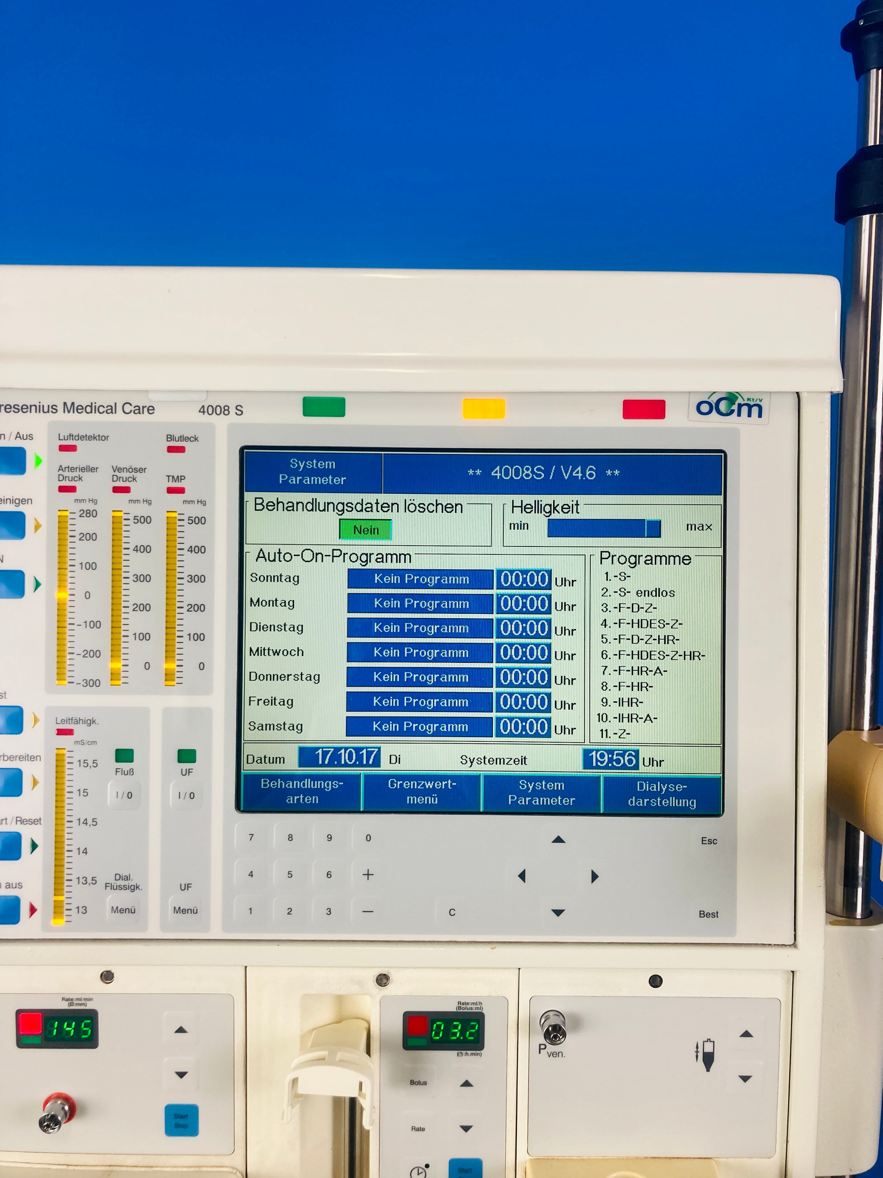 Fresenius Medical Care 4008S Dialysis Machine – MedGill Ltd