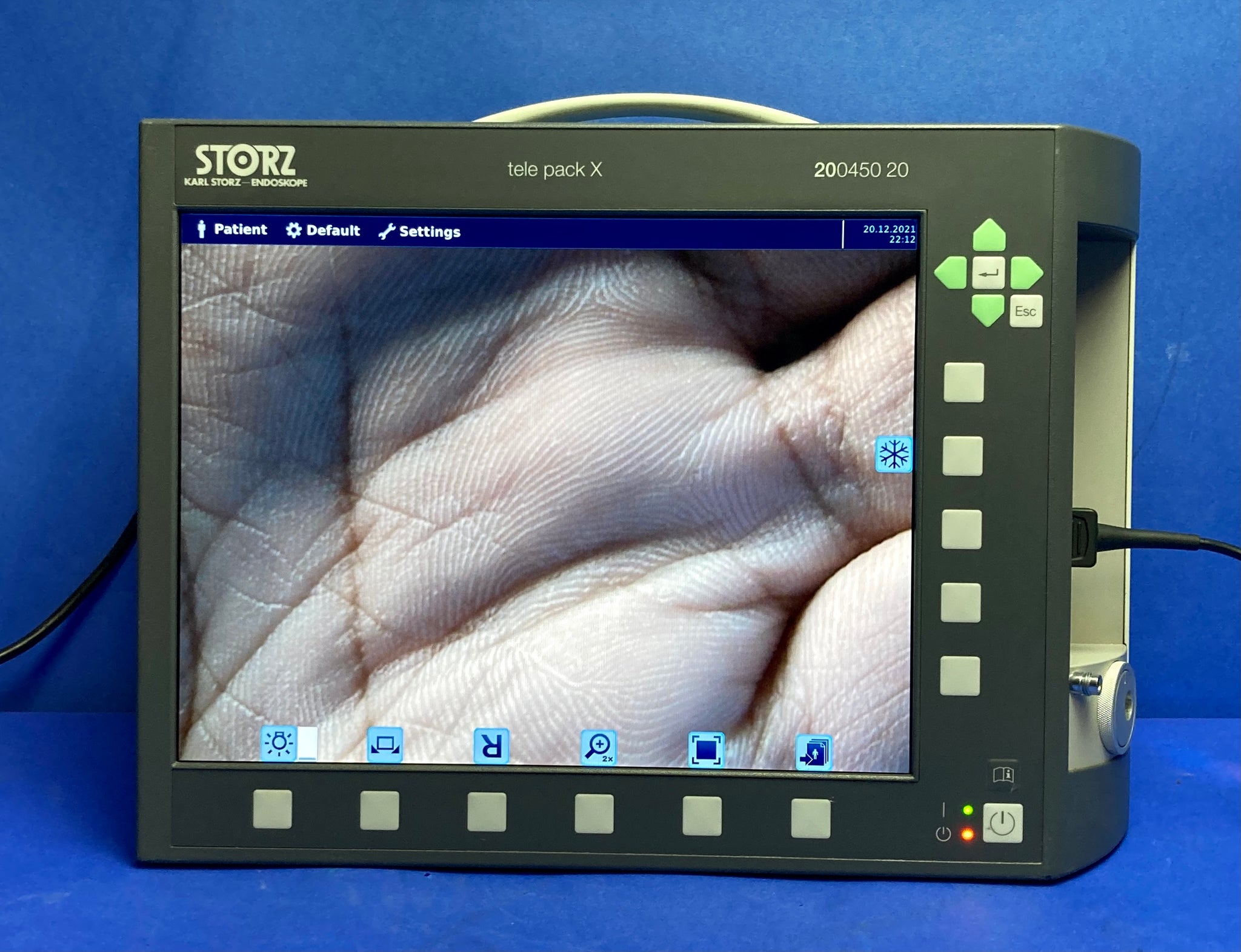 Karl Storz Endoskope tele pack X 200450 20 Mobile Endoscopy System ...